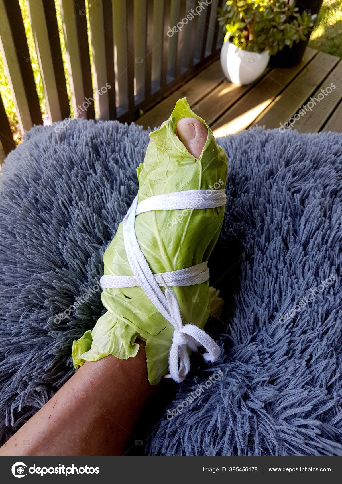 Patas Envueltas Con Hojas Repollo Blanco Las Hojas Repollo Pueden ...