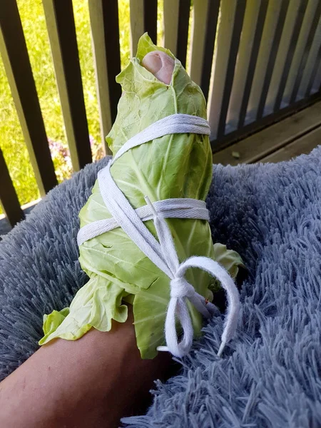 Patas envueltas con hojas de repollo blanco.Las hojas de repollo pueden ...