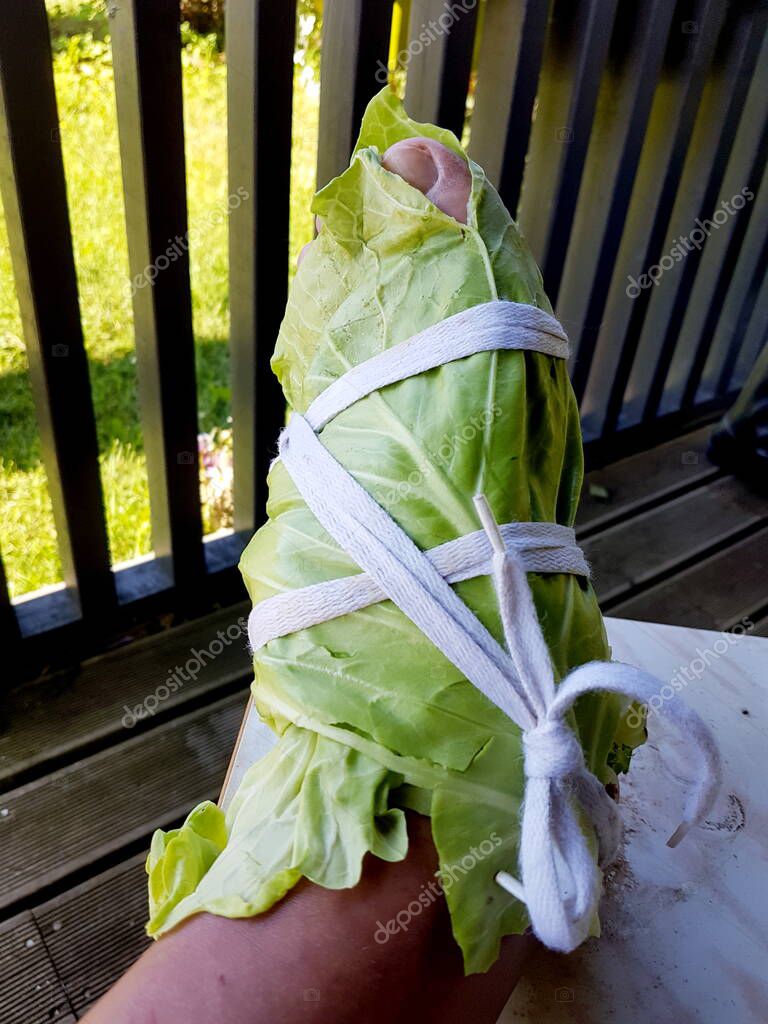 Patas envueltas con hojas de repollo blanco.Las hojas de repollo pueden ...