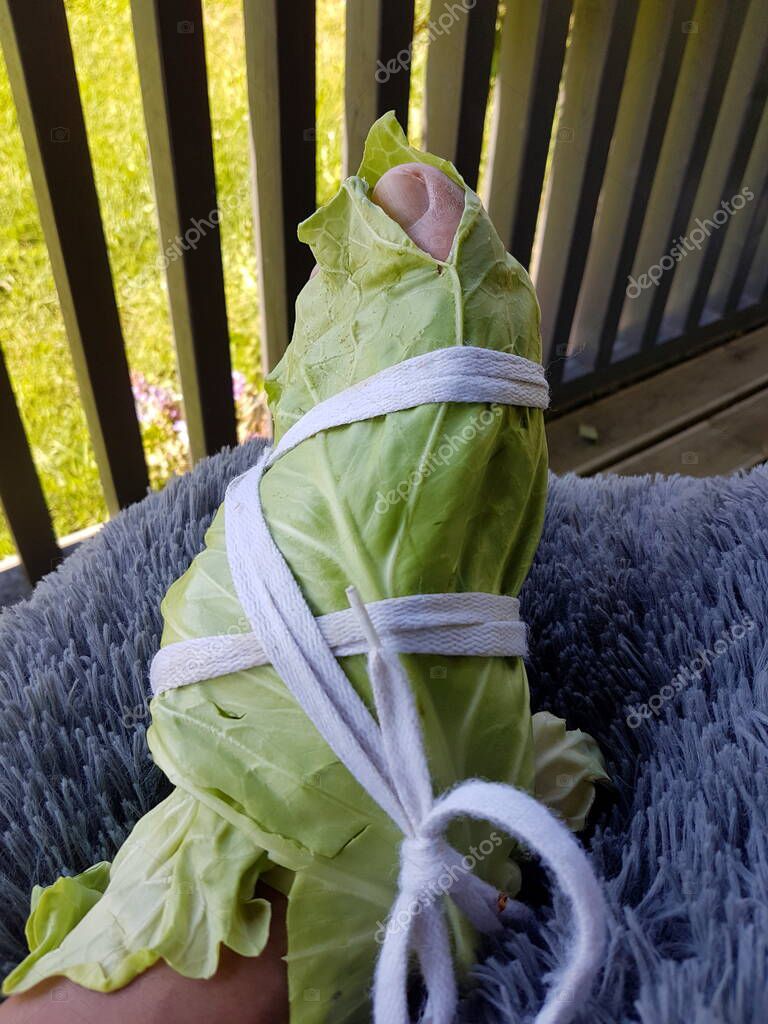 Patas envueltas con hojas de repollo blanco.Las hojas de repollo pueden ...