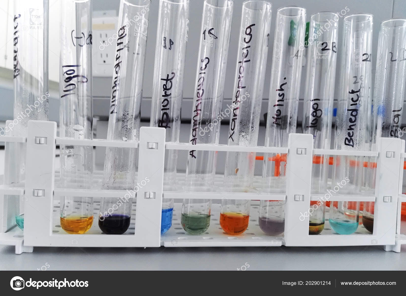 Prueba Laboratorio Para Determinación Carbohidratos Proteínas Lugol ...