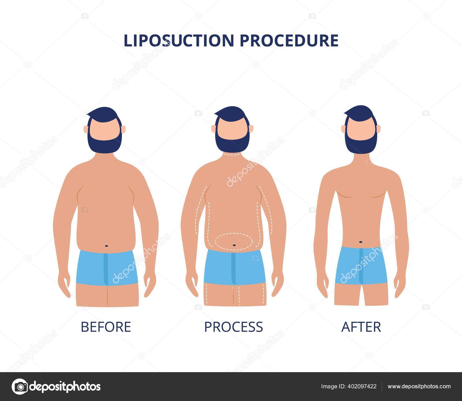 Before And After Cartoon Person
