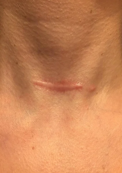 Face scar Stock Photos, Royalty Free Face scar Images | Depositphotos