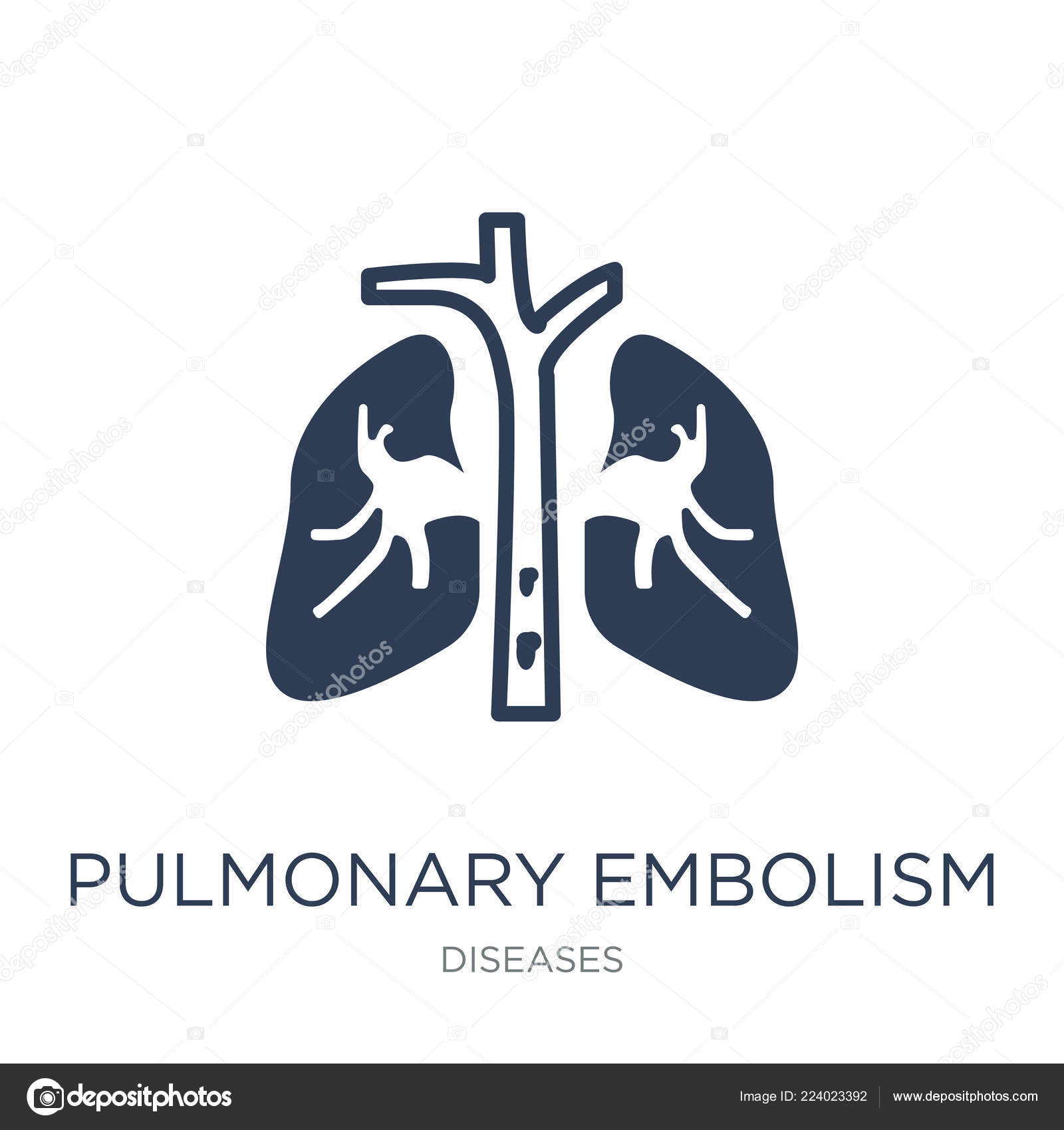 Pulmonary Embolism Icon Trendy Flat Vector Pulmonary Embolism Icon ...