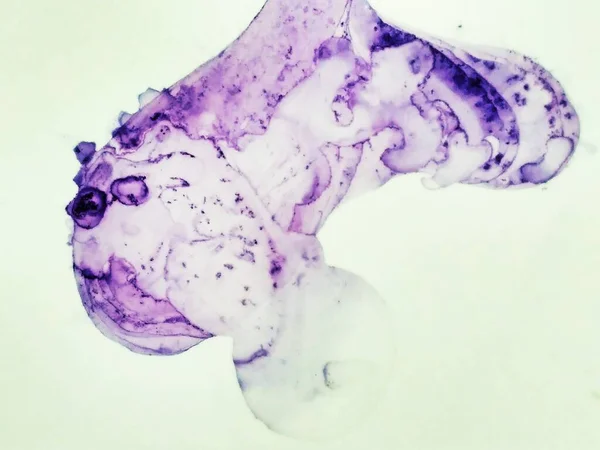 Osteoporosis ear Stock Photos, Royalty Free Osteoporosis ear Images ...