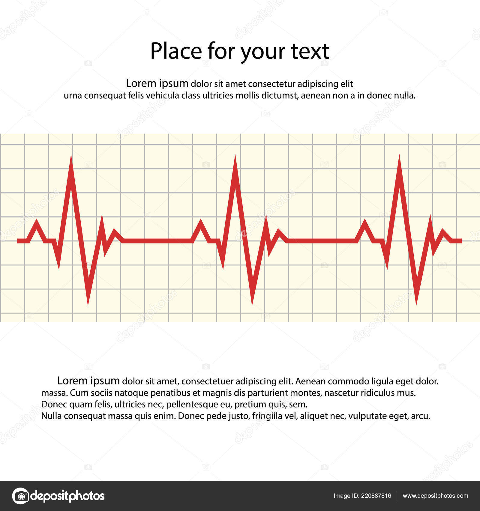 Normal Heart Rate Line