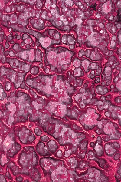 Reticular Tissue Under Microscope