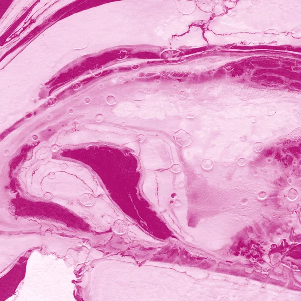 Pathology in the uterus Stock Photos, Royalty Free Pathology in the ...