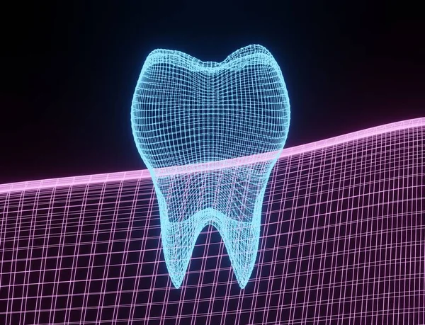 Tooth Wireframe Mesh. Neon grid molar. Connection Structure. Dental ...