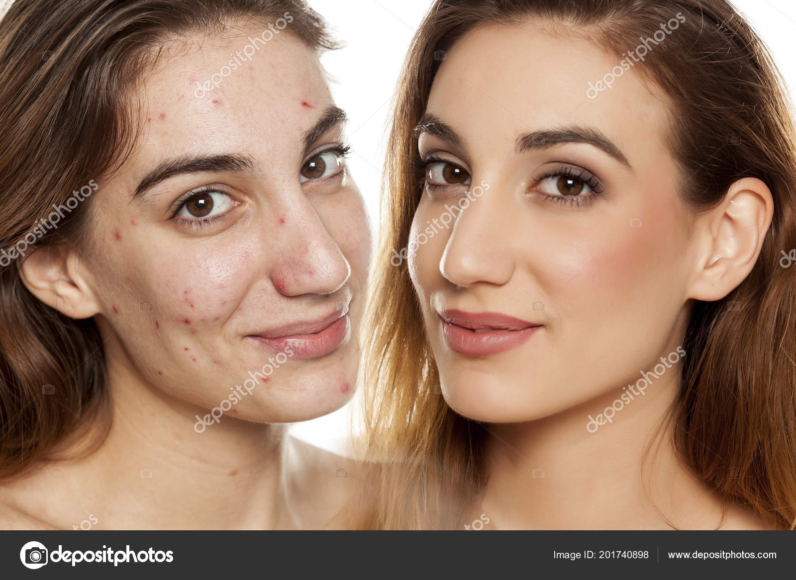 Comparison Portrait Same Woman Cosmetic Treatment Makeup White ...