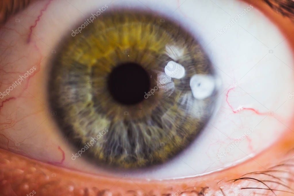 ojo humano abierto de par en par con las arterias rojas brillantes de ...