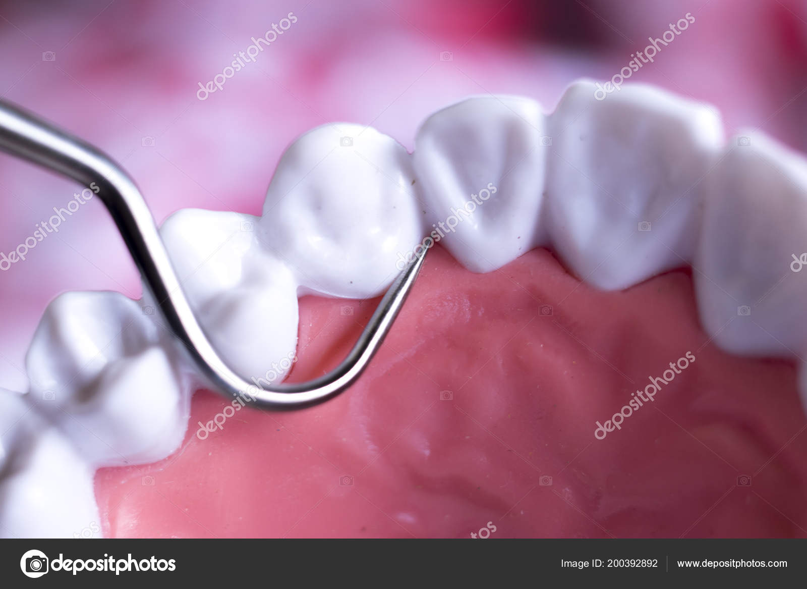 Dentist Cleaning Teeth Titanium Metal Tooth Pick Instrument Remove ...