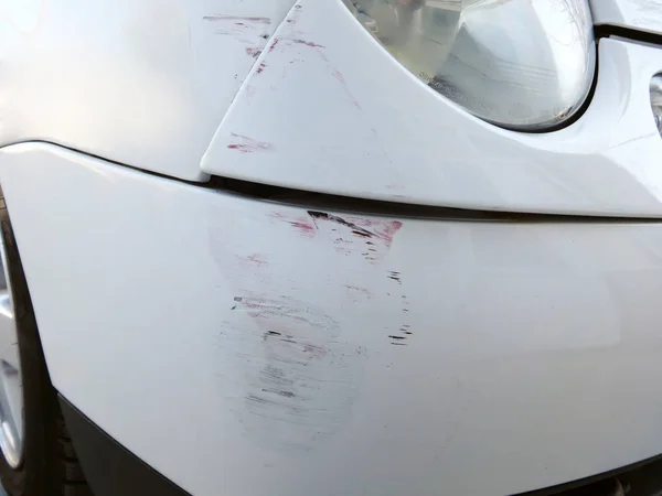 Accidente victima heridas Stock Photos, Royalty Free Accidente victima ...