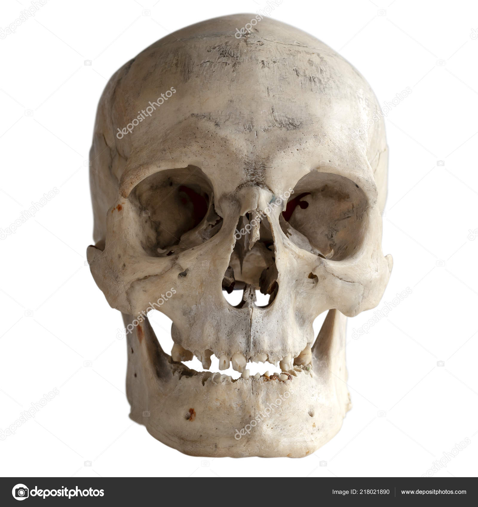 Human Skull Side View Mouth Open