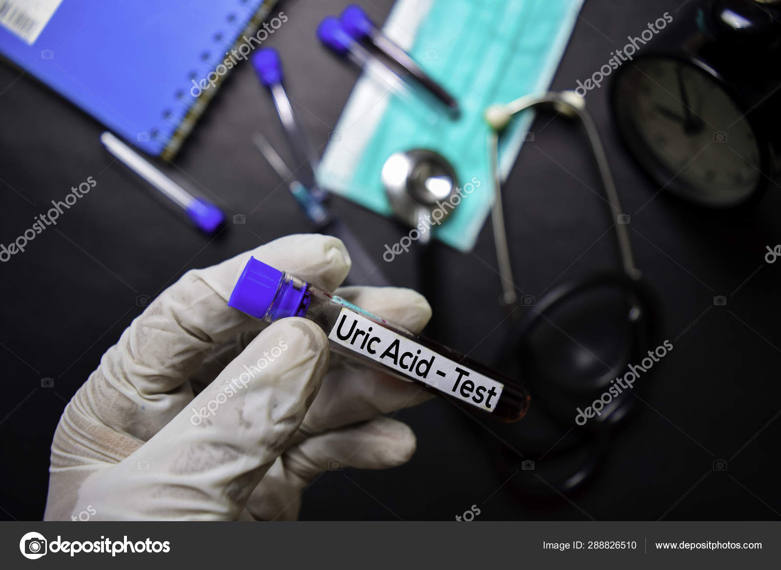 Uric Acid - Test with blood sample. Top view isolated on black ...
