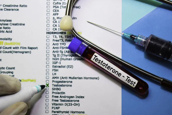 Fructosamine - Test with blood sample. Top view isolated on office desk ...