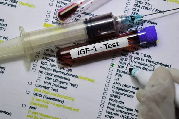 Coagulation Panel - Test with blood sample. Top view isolated on office ...
