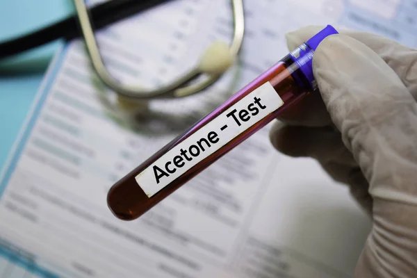 Ketone test Stock Photos, Royalty Free Ketone test Images | Depositphotos®
