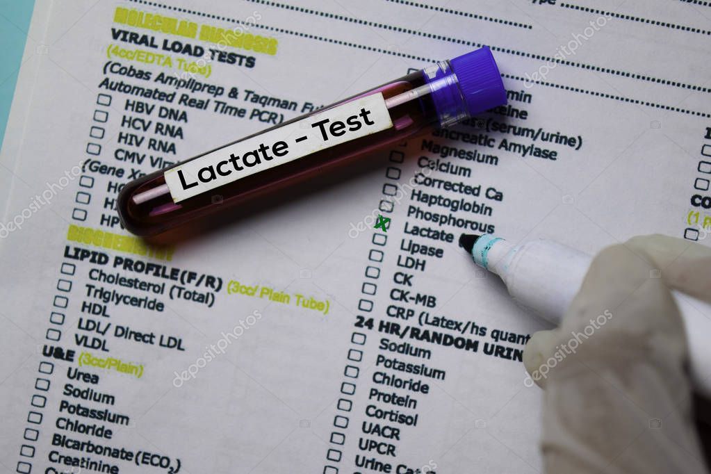 Lactato: prueba con muestra de sangre. Vista superior aislada en el ...