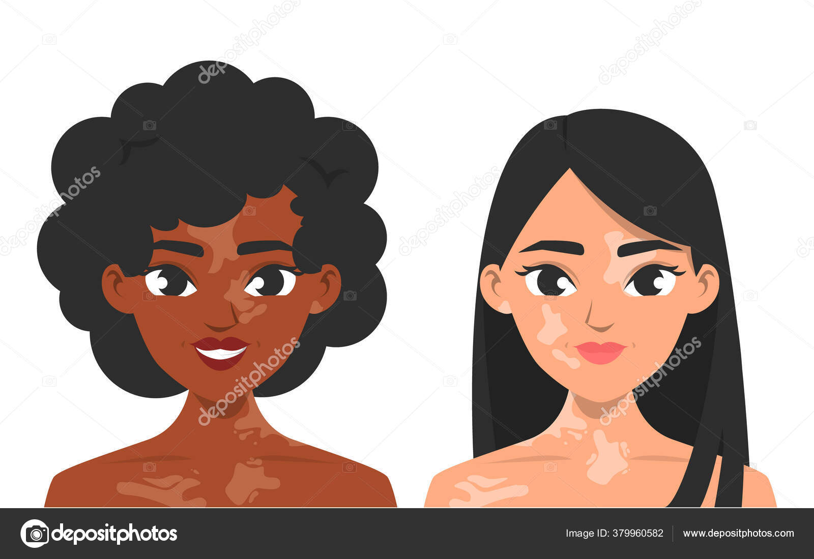 Vitiligo Cartoon