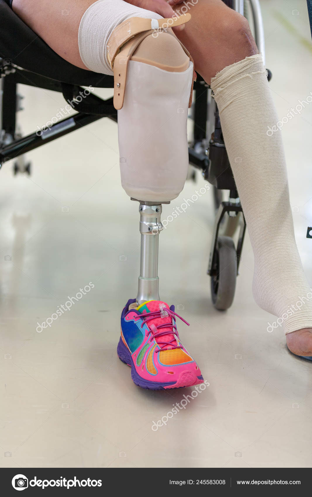 Close New Prosthetic Leg New Middle Aged Female Personal Trainer ...