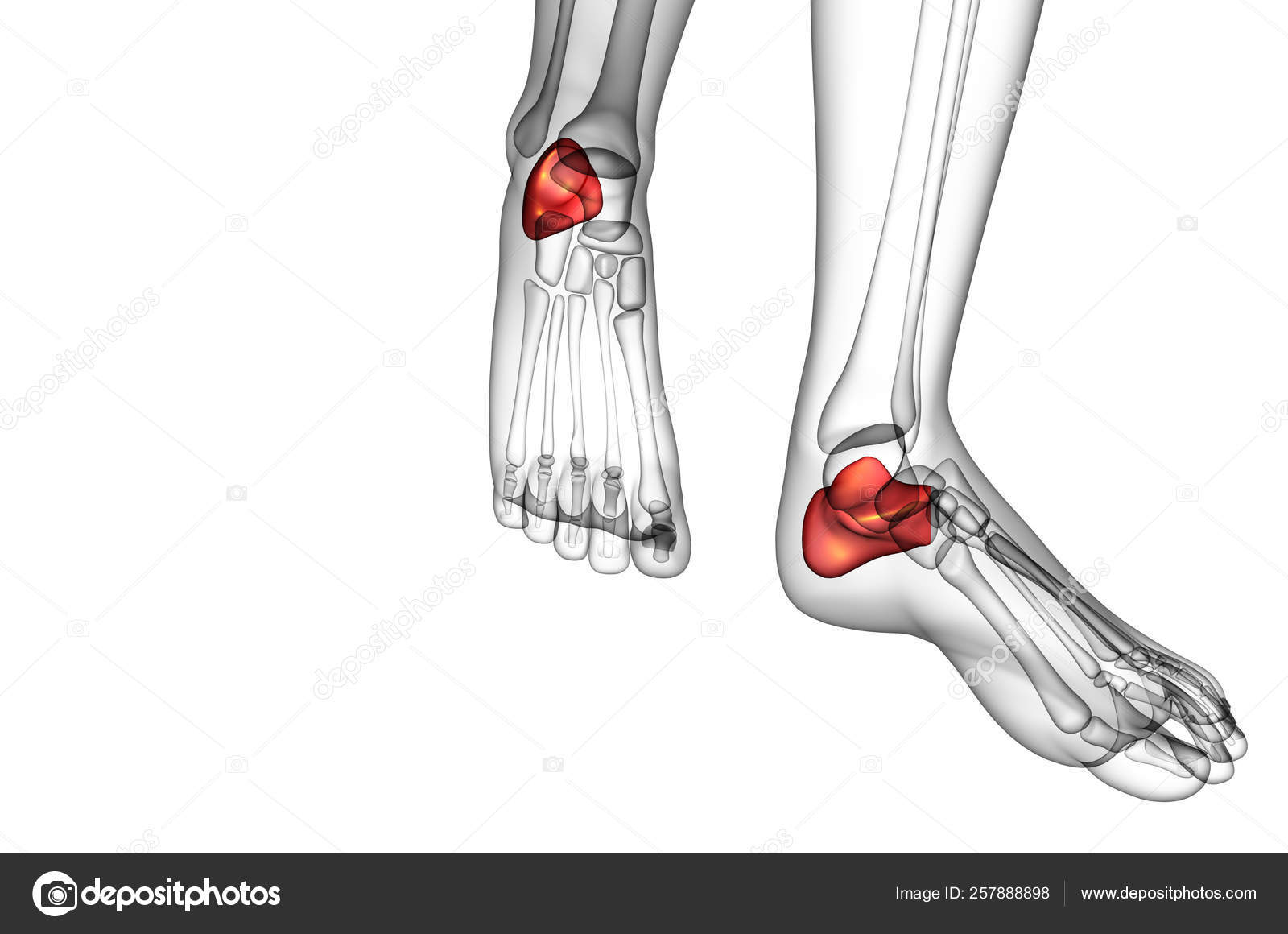 Calcaneus