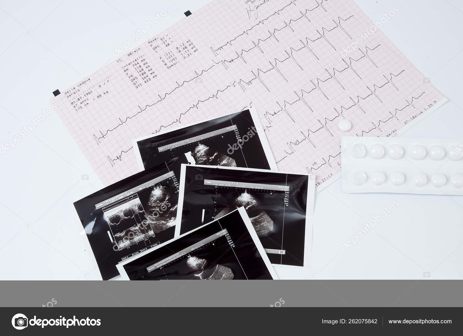 Tracing Electrocardiogram Ultrasound — Stock Photo © YAYImages #262075842