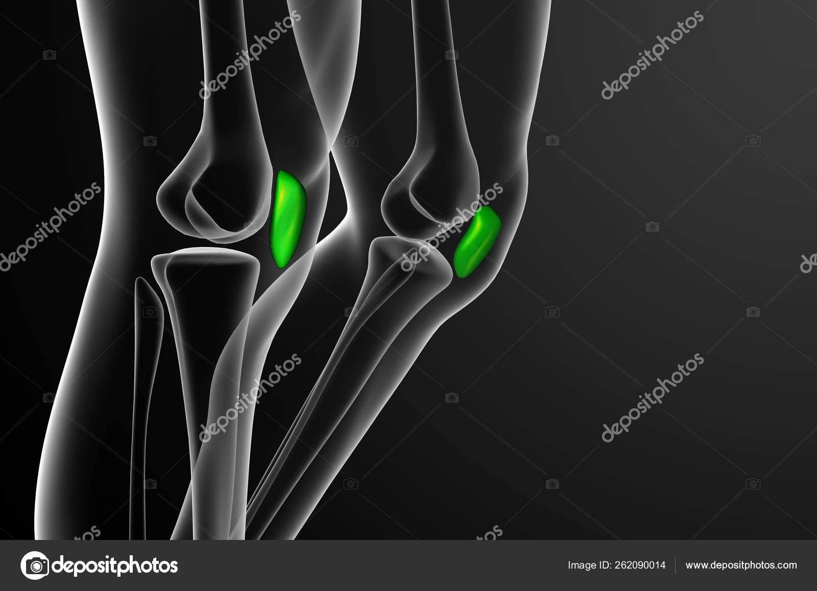 Render Medical Illustration Patella Bone Side View Stock Photo by ...