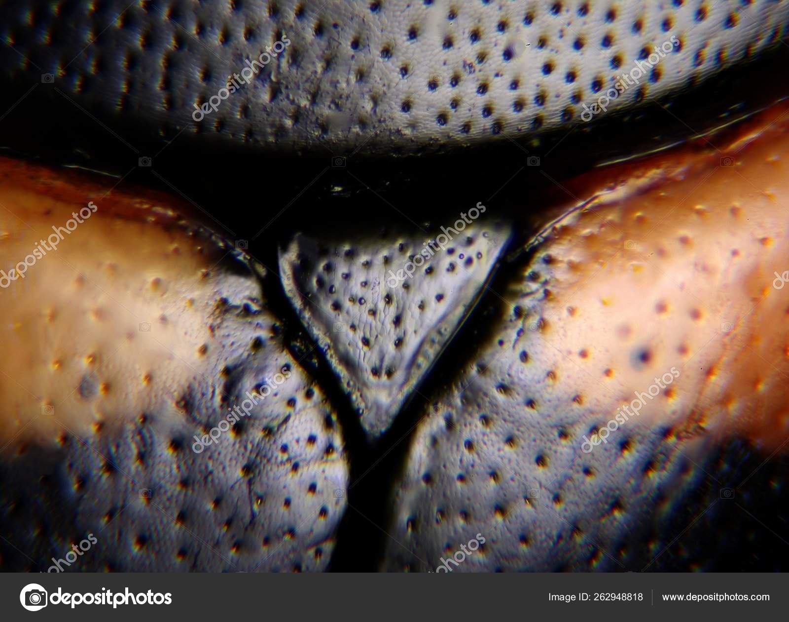 Micrograph Ladybird Insect Using Compound Microscope Magnification 100X ...