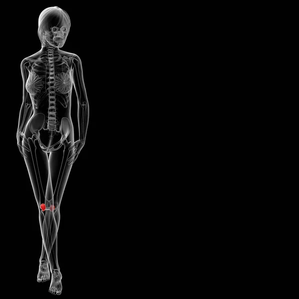 Tendinopatia Stock Photos, Royalty Free Tendinopatia Images | Depositphotos