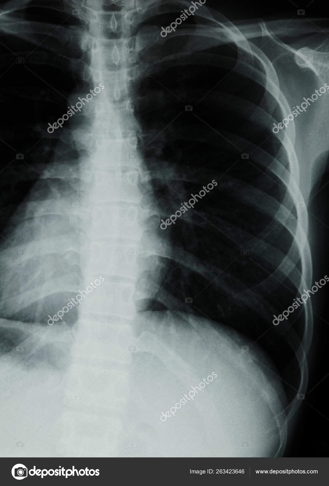 Chest Xray Scan Background Stock Photo by ©YAYImages 263423646