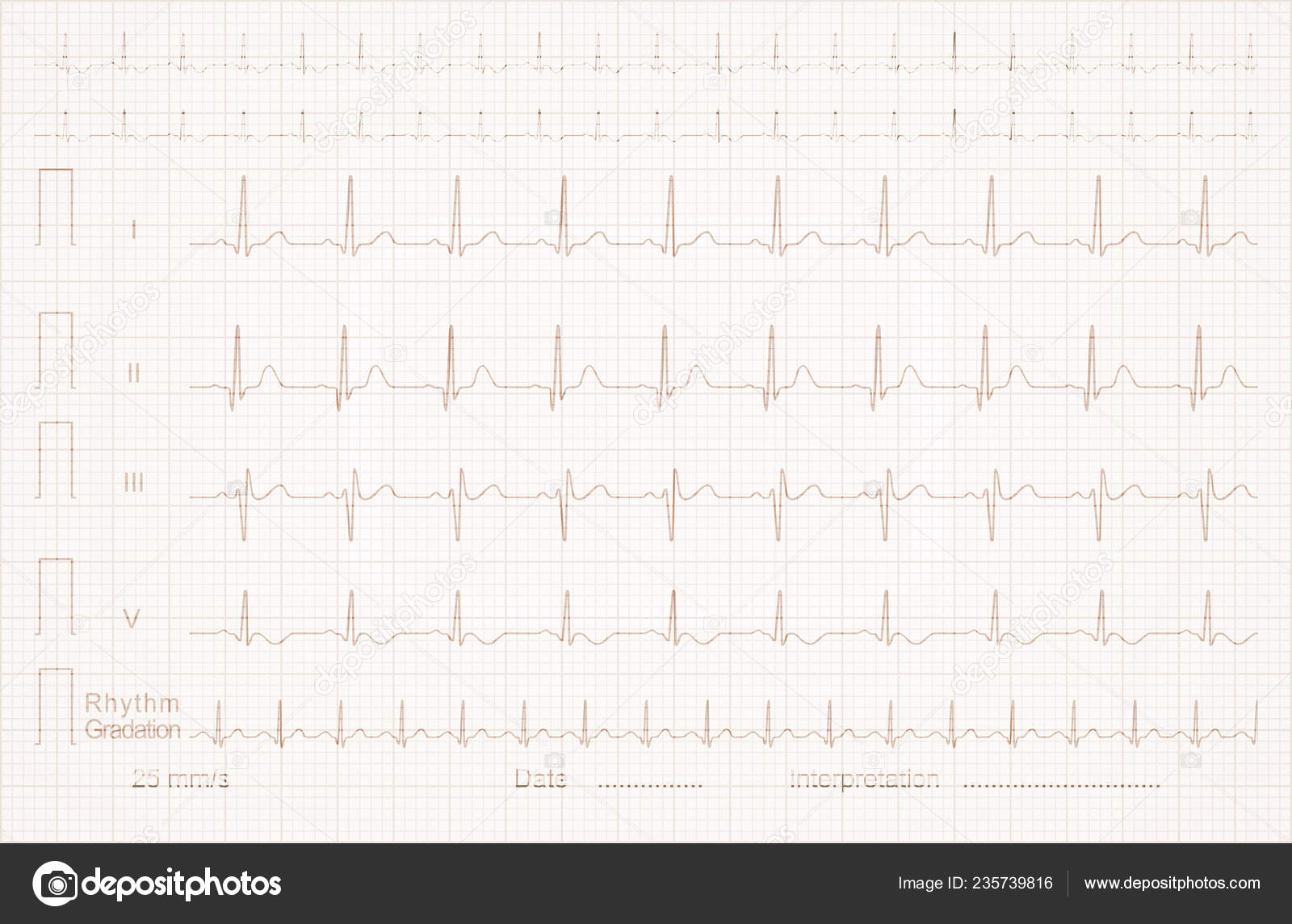 Ecg Cardiogram Linear Graph Paper Stock Photo by ©sudok1 235739816