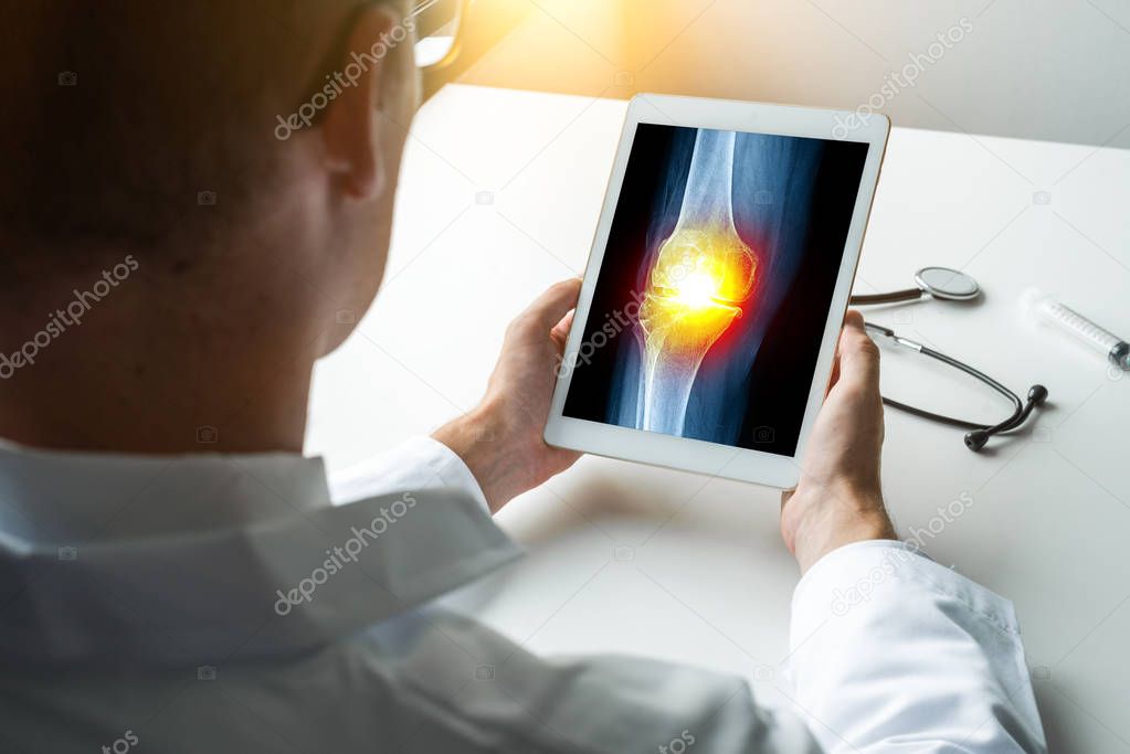 Médico sosteniendo una tableta digital con rayos X de pierna con dolor ...