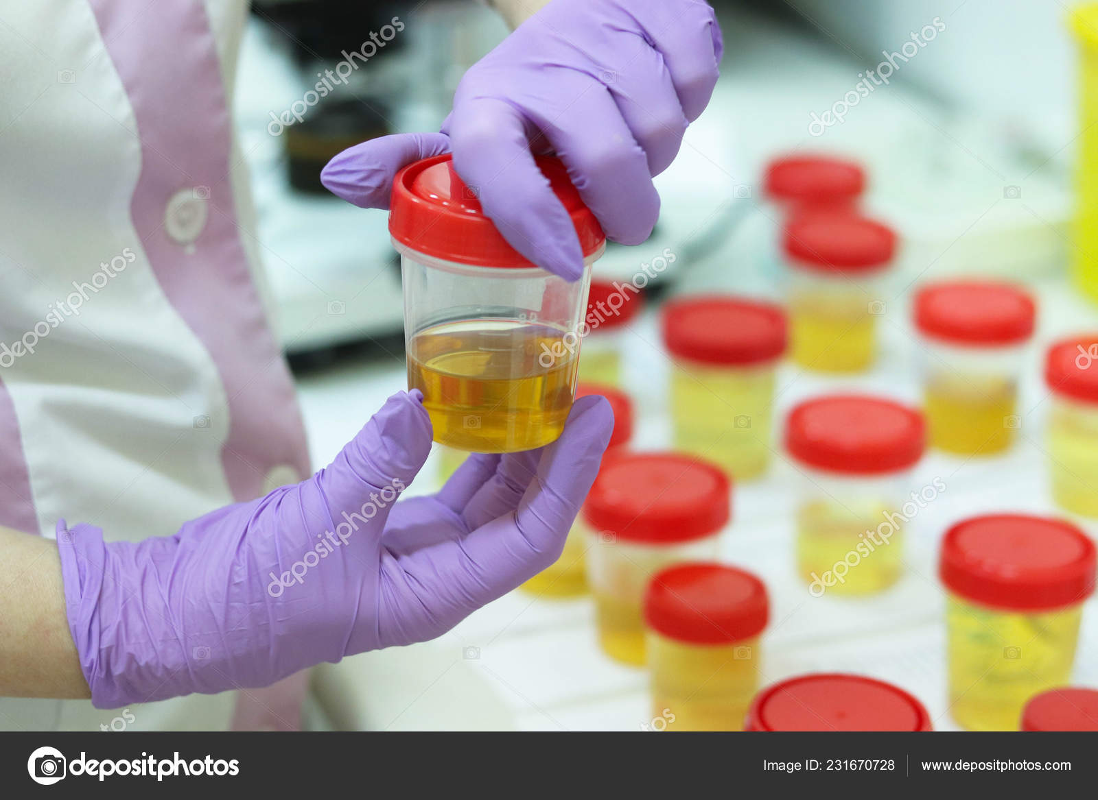 Preparation Urine Samples Laboratory Hospital Study Special Test Strips ...