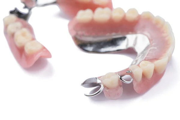 Removable Partial Denture Upper
