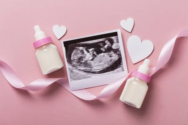 Baby scan Pictures, Baby scan Stock Photos & Images | Depositphotos®