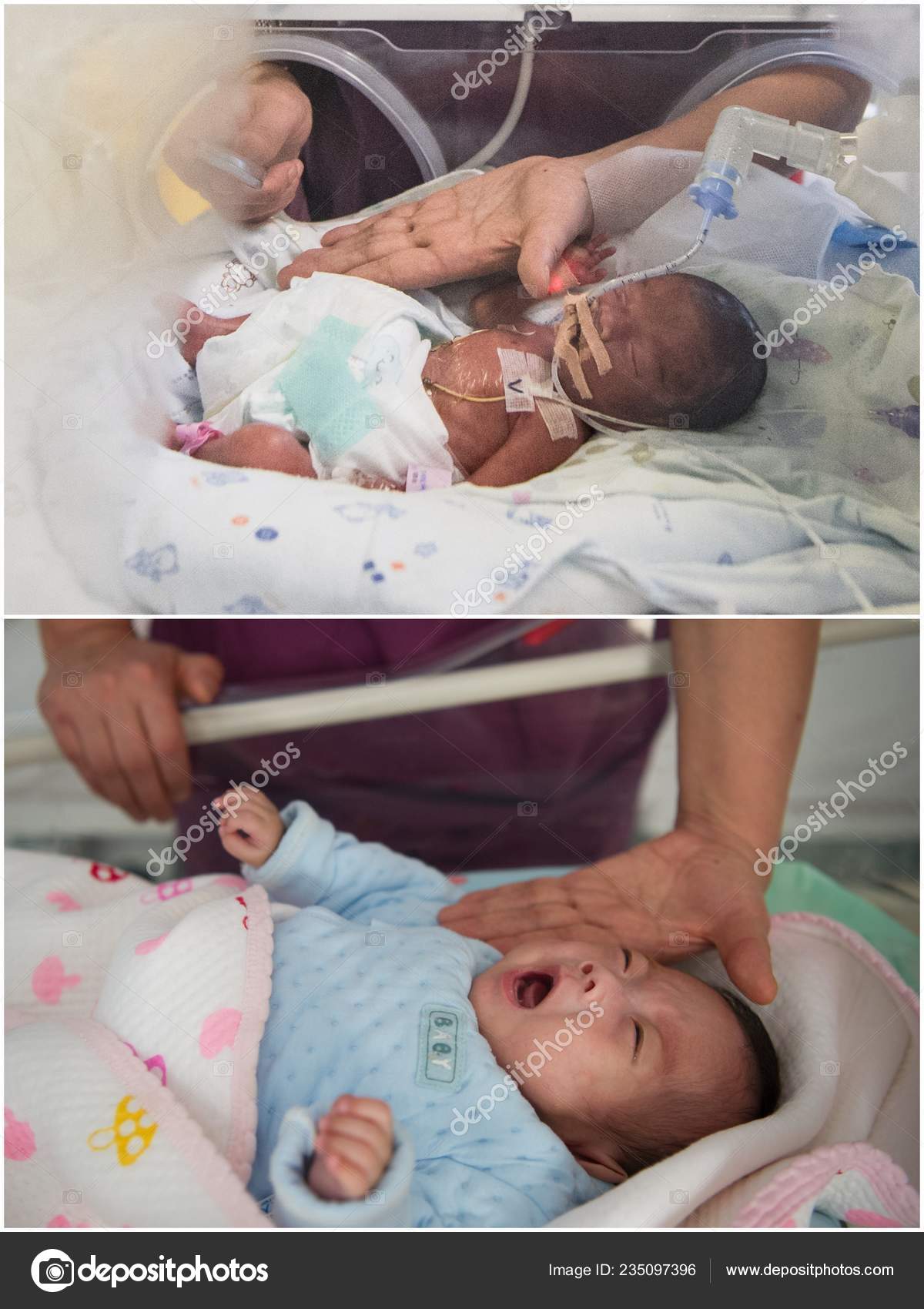 Composite Photo Shows Doctor Measuring Premature Baby Named Chen ...