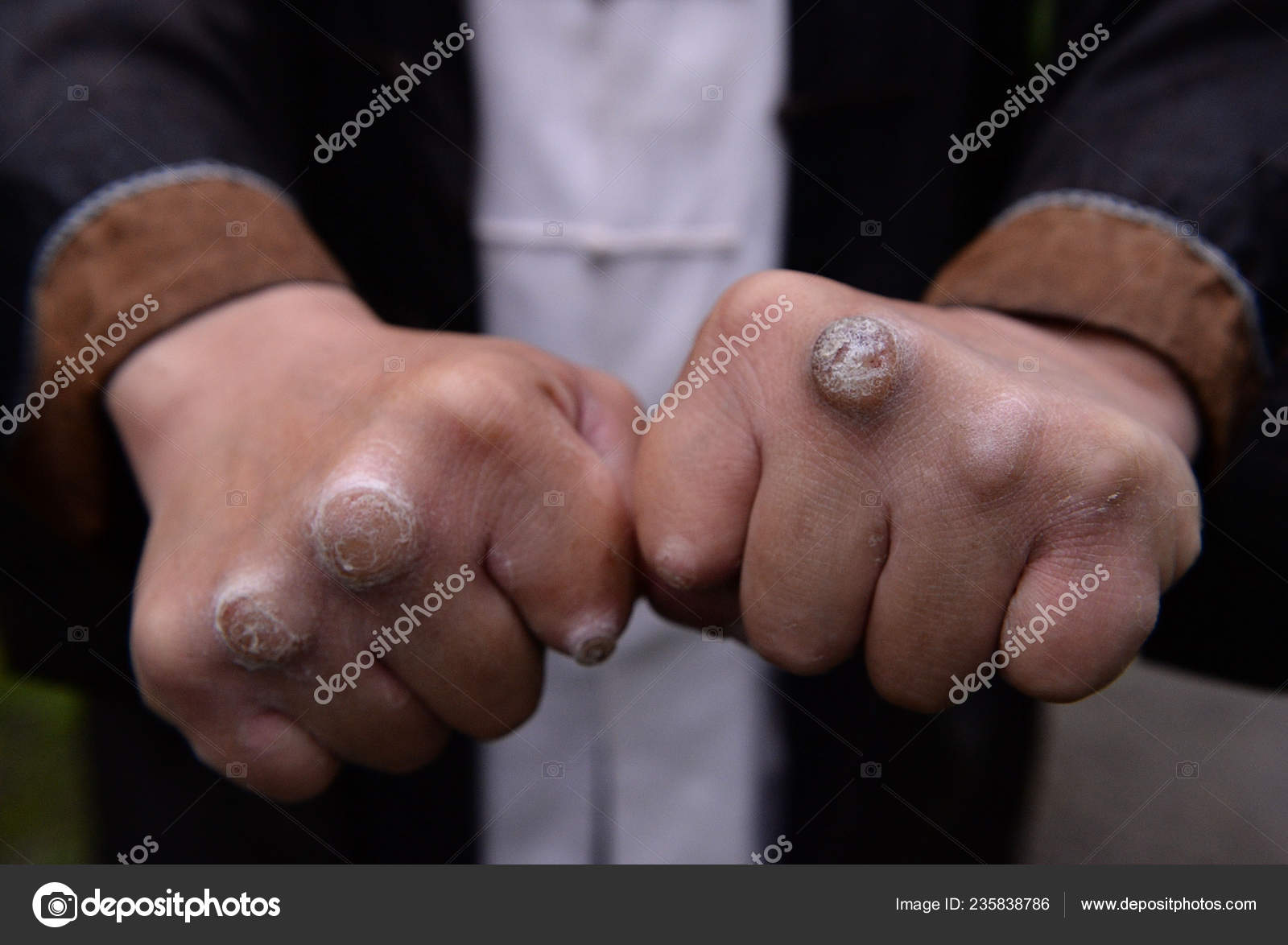 View Callus Hands Daojun Master Chengdu Qingcheng Kungfu Mount ...