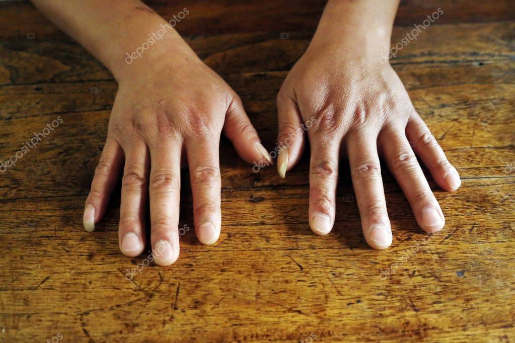 Zhu Linjie, uno de los 10 inspectores certificados de sandía de la ciudad, muestra sus manos ...