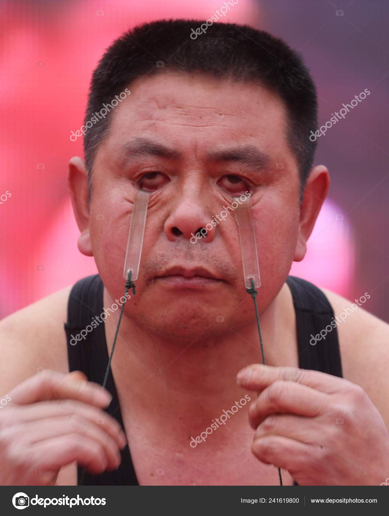 Chinese Farmer Wang Xianxiang Puts Two Plastic Hooks His Lower — Stock ...