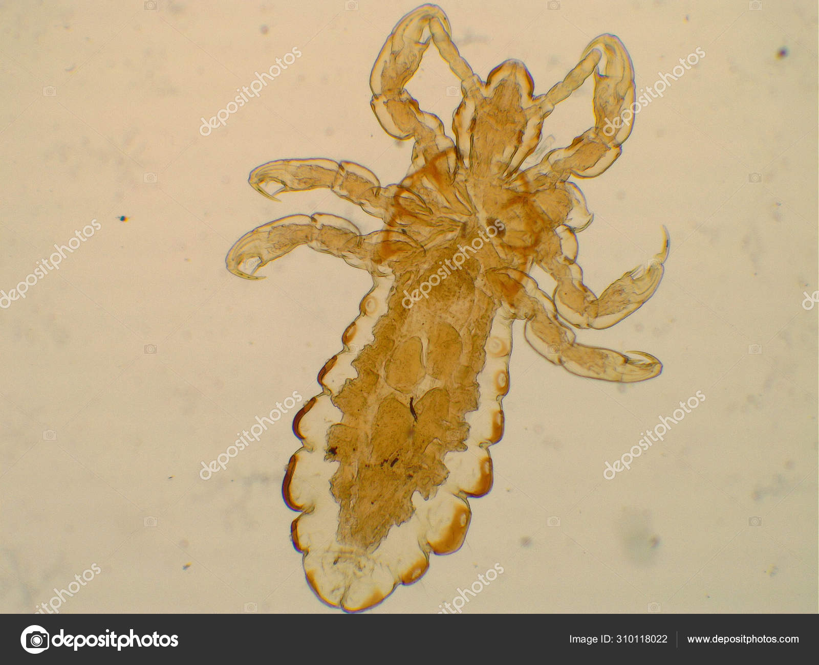 Head louse (Pediculus humanus capitis) under microscope. Stock Photo by ...