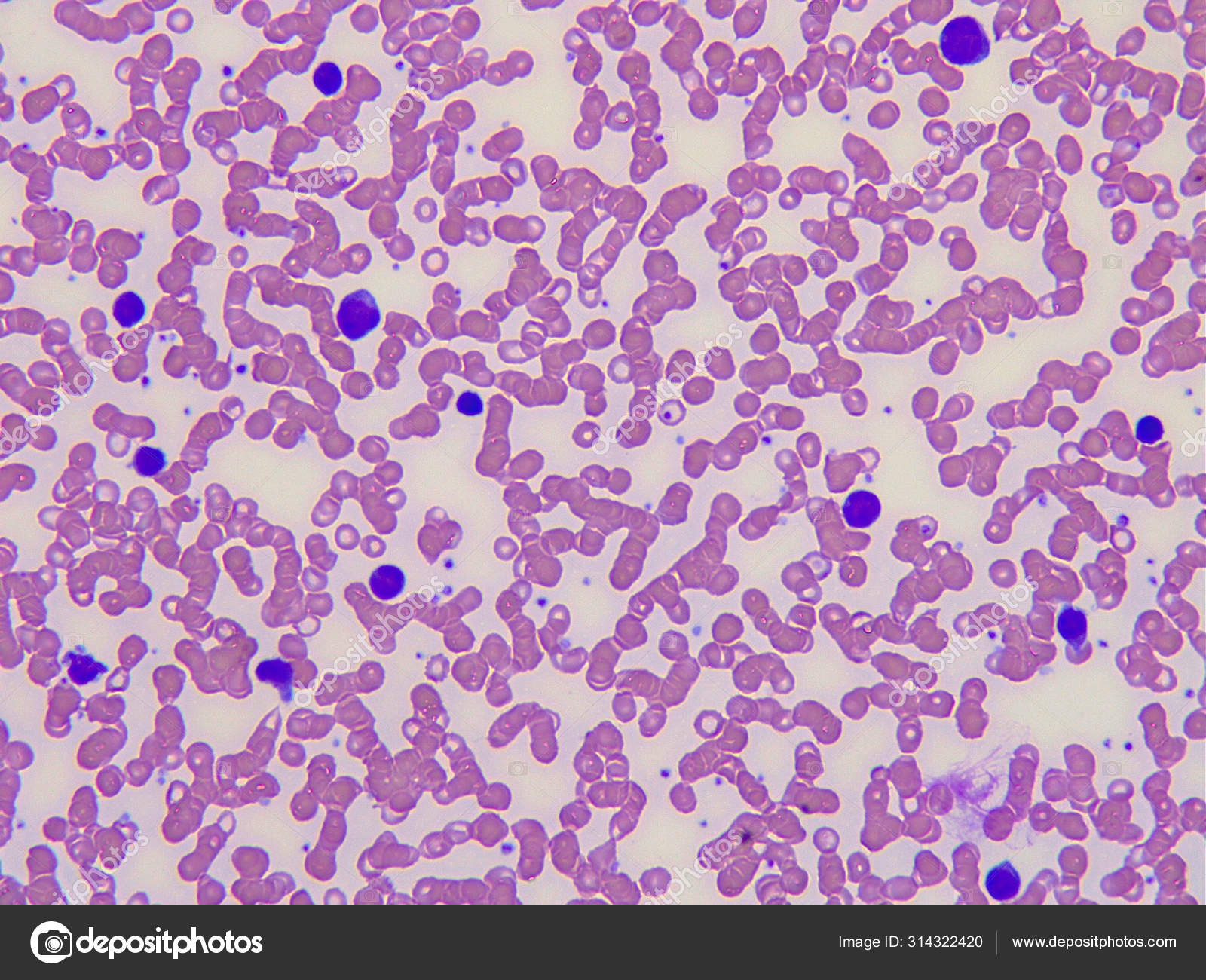Blood 400x Red Blood Cells The Central Pallor Of The Rbcs Relates To