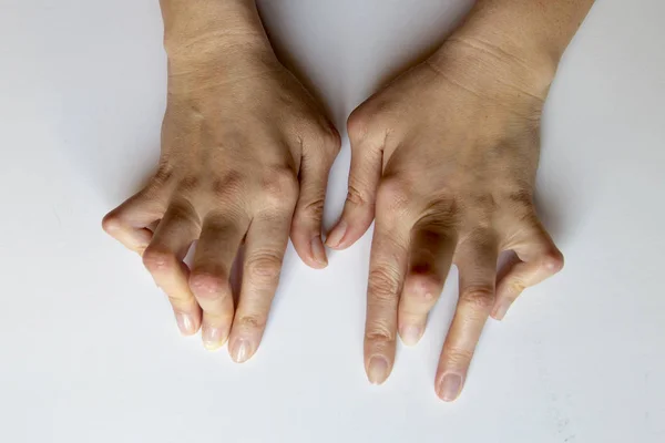 Deformed Stock Photos, Royalty Free Deformed Images | Depositphotos