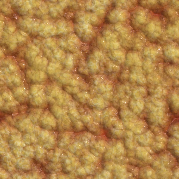 Fat tissue Stock Photos, Royalty Free Fat tissue Images | Depositphotos®