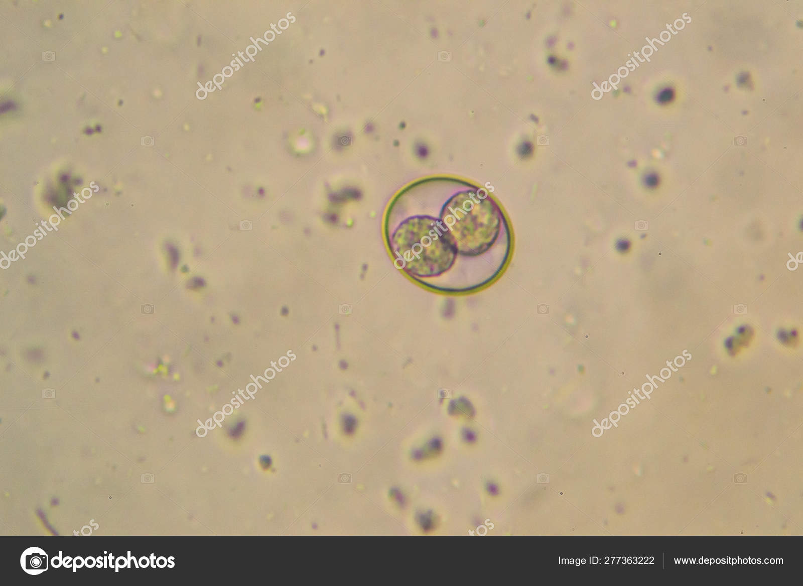 Coccidia Isospora