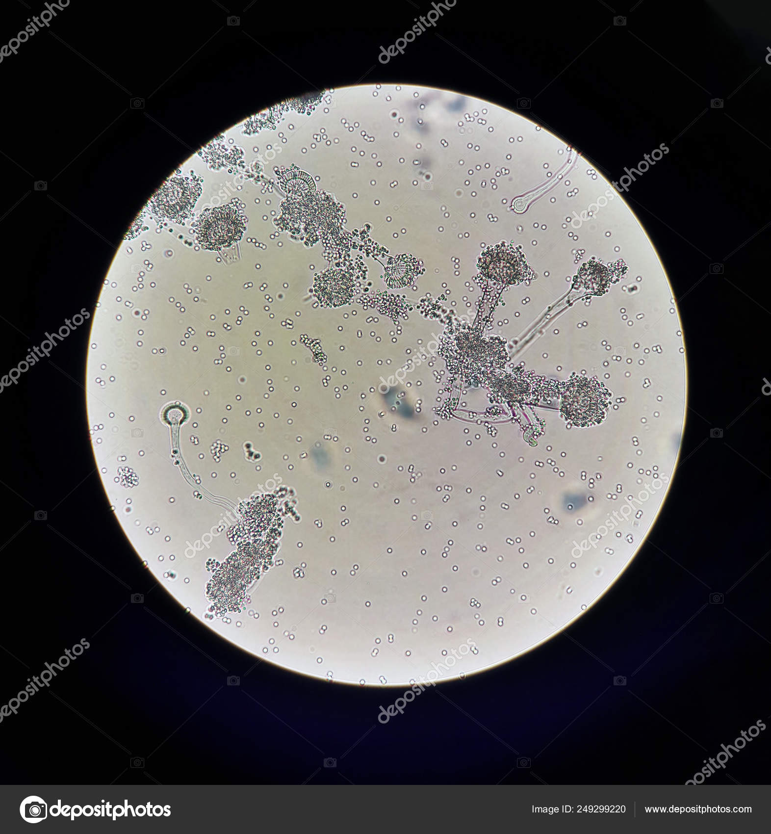 Hongos bajo vista microscópica Aspergillus. Microbiología de hongos ...
