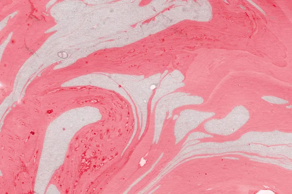 Atopic derm Stock Photos, Royalty Free Atopic derm Images | Depositphotos