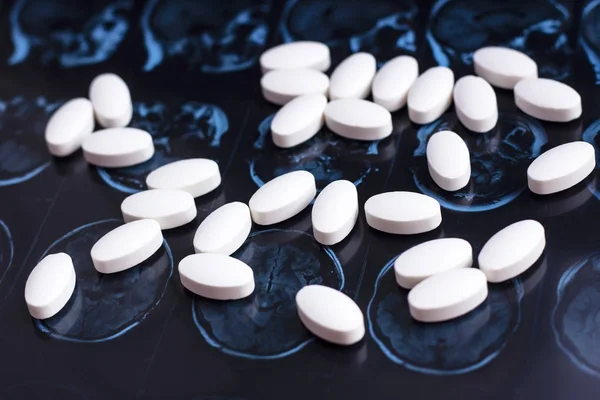White Pharmaceutical Medicine Pills Magnetic Brain Resonance Scan Mri ...