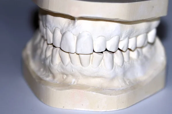 Dental gypsum model mould of teeth in plaster — Stock Photo © Voyagerix ...