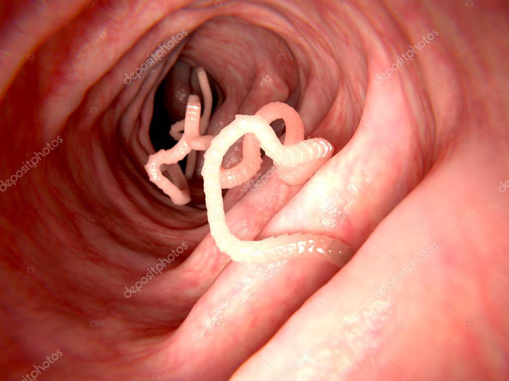 La tenia en el intestino humano. Representaci n 3D. Las tenias son una ...